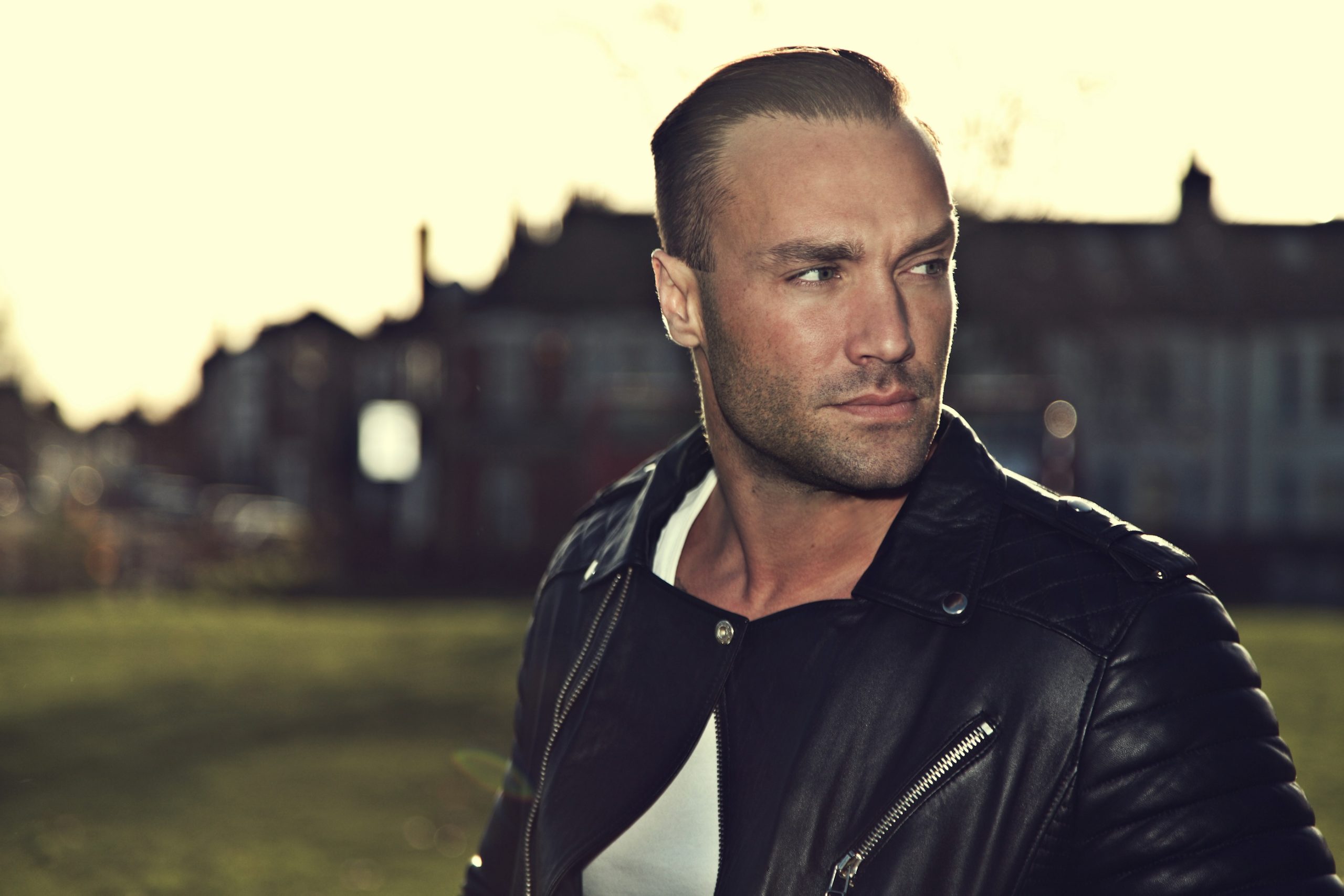Calum Best | Hair Transplant Case Study | Crown Clinic
