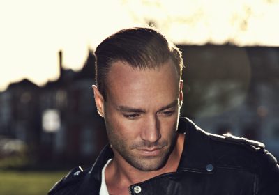 Calum Best | Hair Transplant Case Study | Crown Clinic